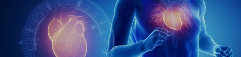 Cardiac CT Scan Los Angeles | Cardiac Imaging | CT Imaging